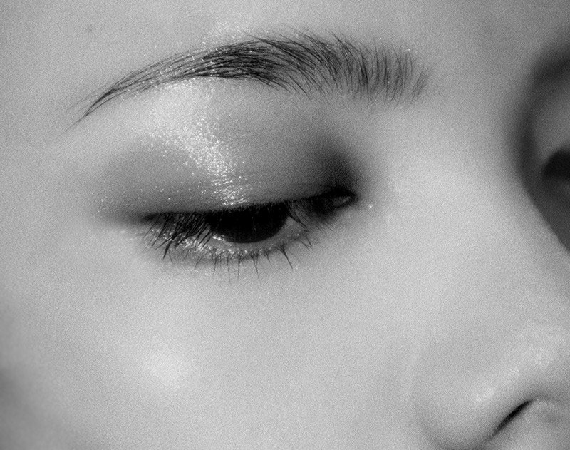 Cosmetic Botox & Filler: Things to Know Before Undereye Botox